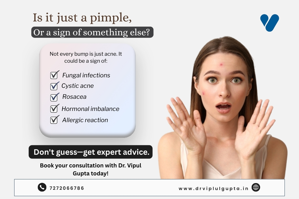 Pimple Removal: 6 Ways to Get Rid of Pimples Fast