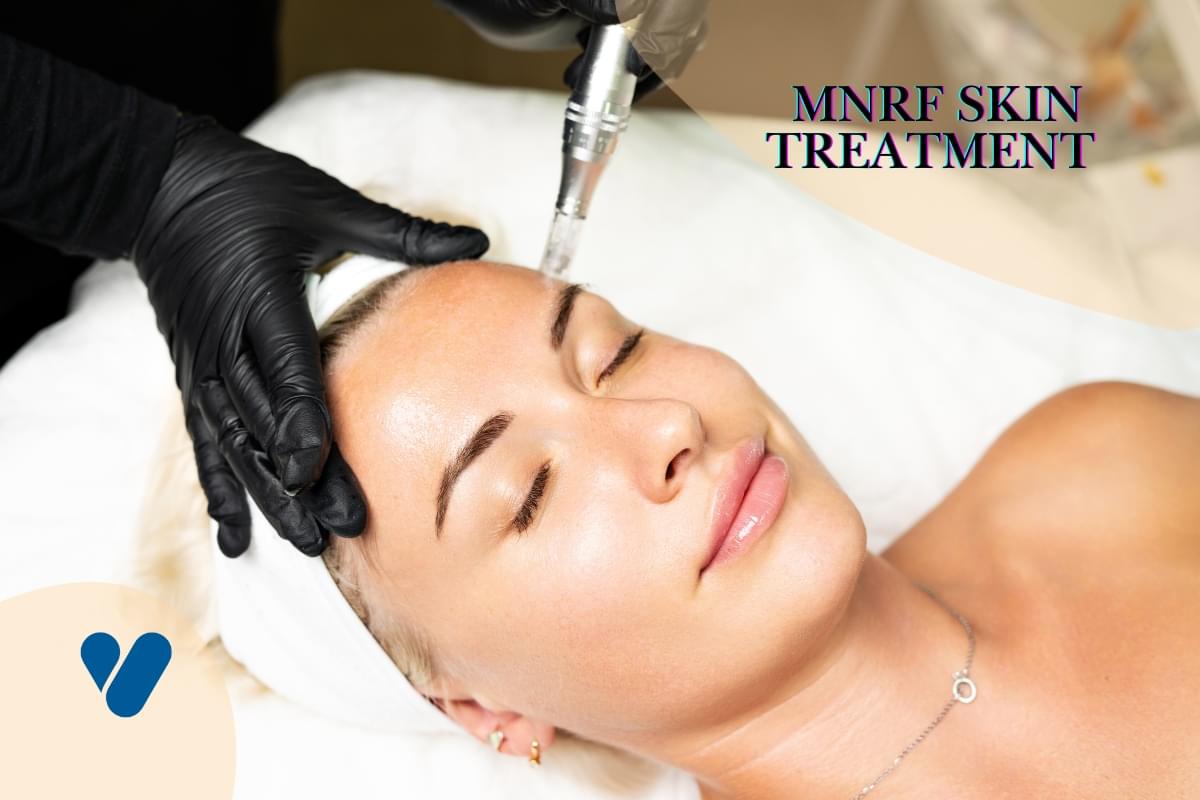 #1 MNRF Treatment | RF Microneedling for Skin Treatment